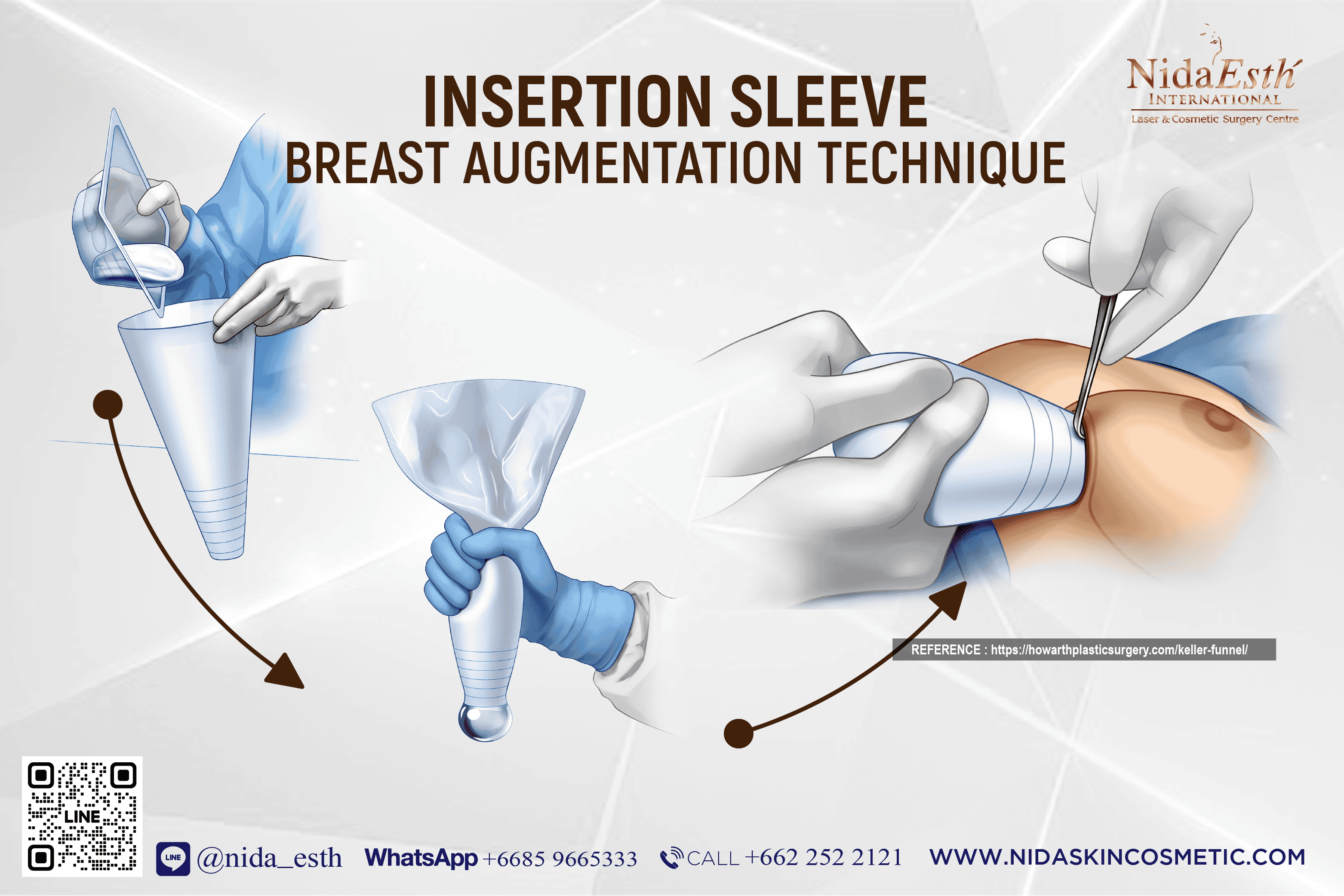 Dr.Piya’s Triple-Advanced Technique Breast Augmentation